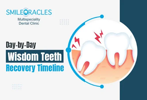 Wisdom Teeth Recovery Timeline - Healing Process Explained